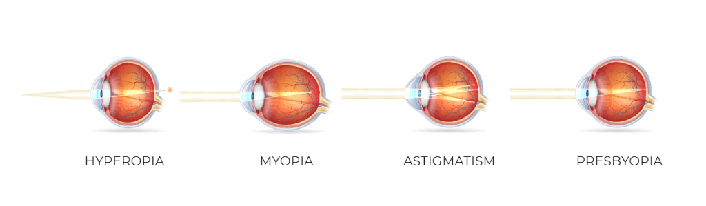 Common Vision Problems - Volunteer Eyecare